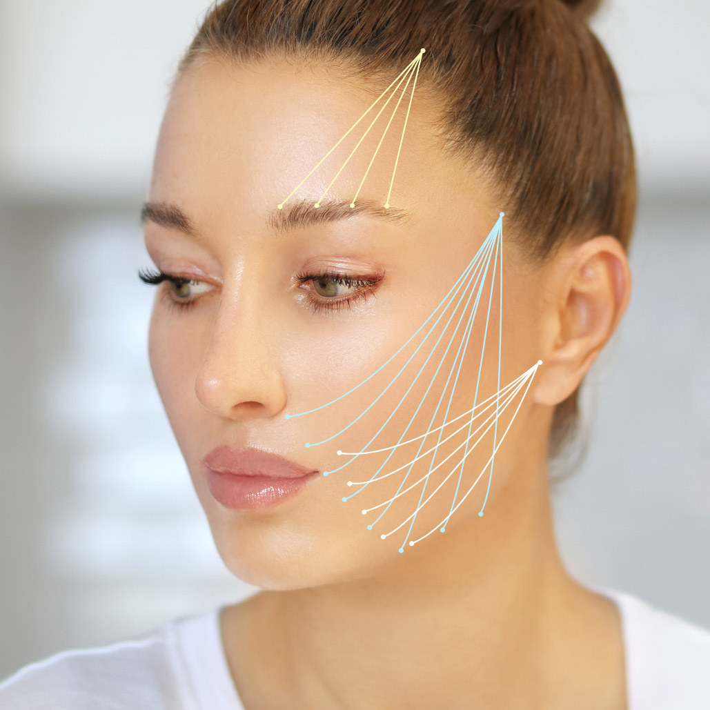 LIFTING FACIAL - Dr. Natalia Rusu - Radzichevici (+373) 69 44 36 95